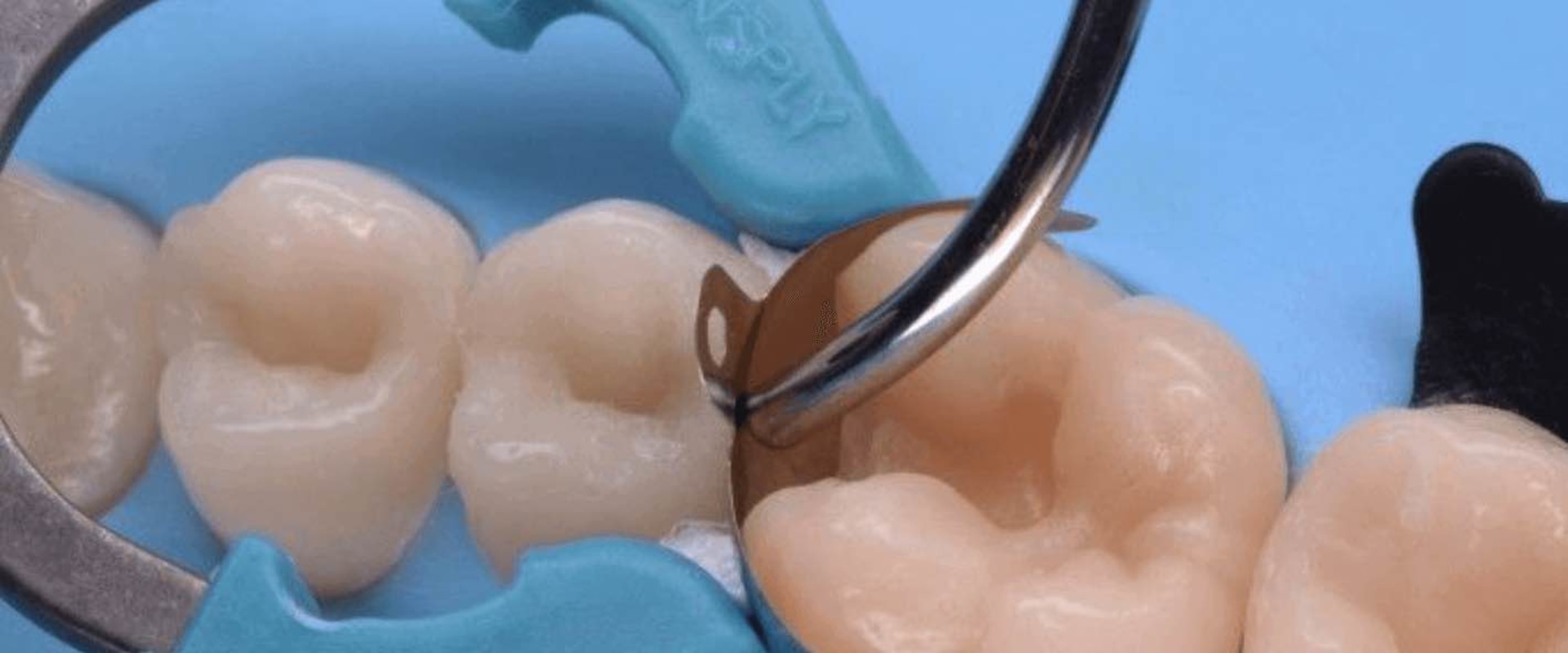 Types of Dental Products and Examples